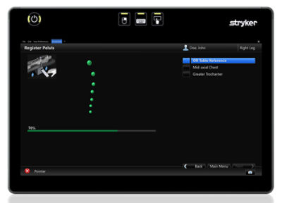OrthoMap Software | Stryker